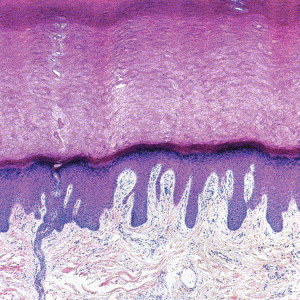 Laxo - O que é, conceito e definição