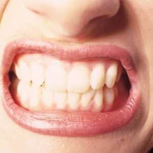 Dente - O que é, problemas, conceito e definição