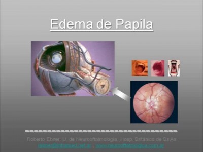 Conceito de papila - O que é, Definição e Significado