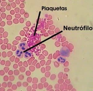 Plaqueta - O que é, conceito e definição