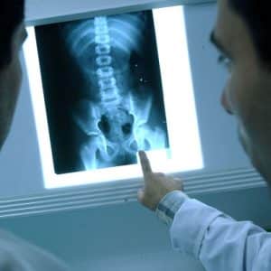 Raio X - O que é, conceito, origem e tipos