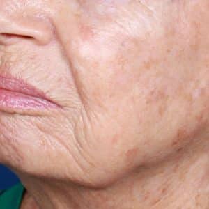 Rugoso - O que é, conceito e definição