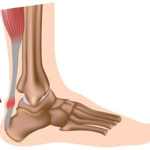 Tendão - O que é, conceito e definição