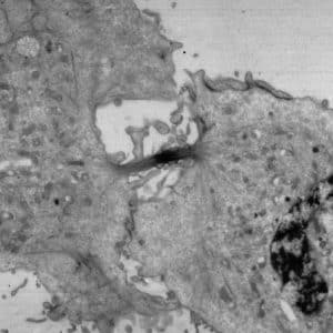 Centrossoma - O que é, conceito e definição