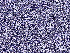 Epífise - O que é, conceito e definição